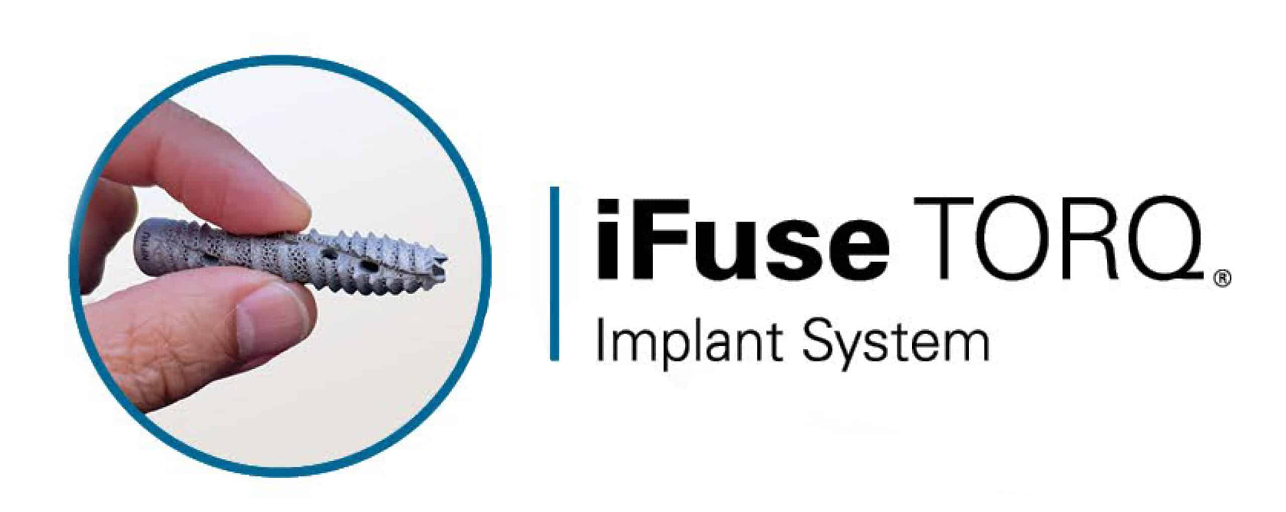 SI-BONE iFuse Implant System - St. Louis Pain Consultants